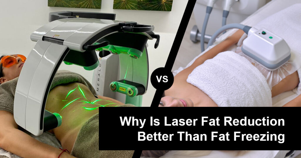 Why Is Laser Fat Reduction Better Than Fat Freezing? - InnovaMed ...